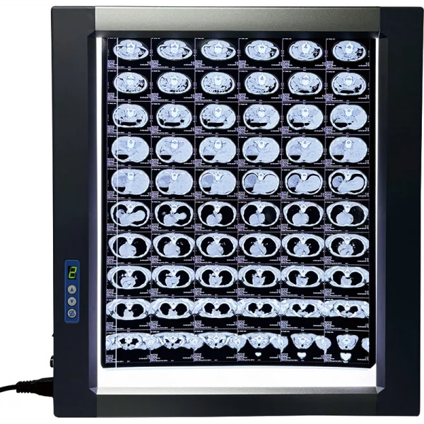 Easywell MST-4000II Double Panel LED X-ray Viewer Price in Bangladesh ...